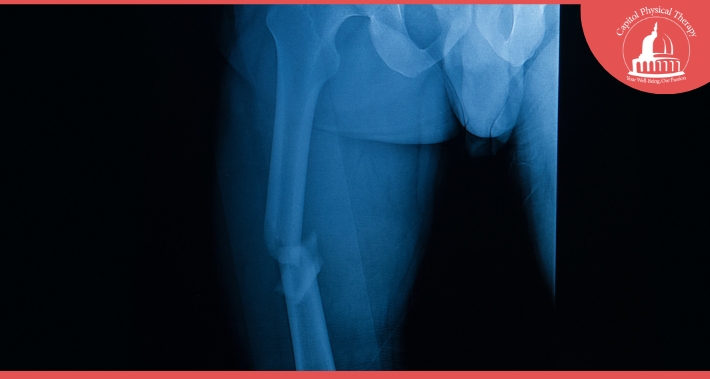 Understanding Your Femur: Function, Injuries, And Physical Therapy ...